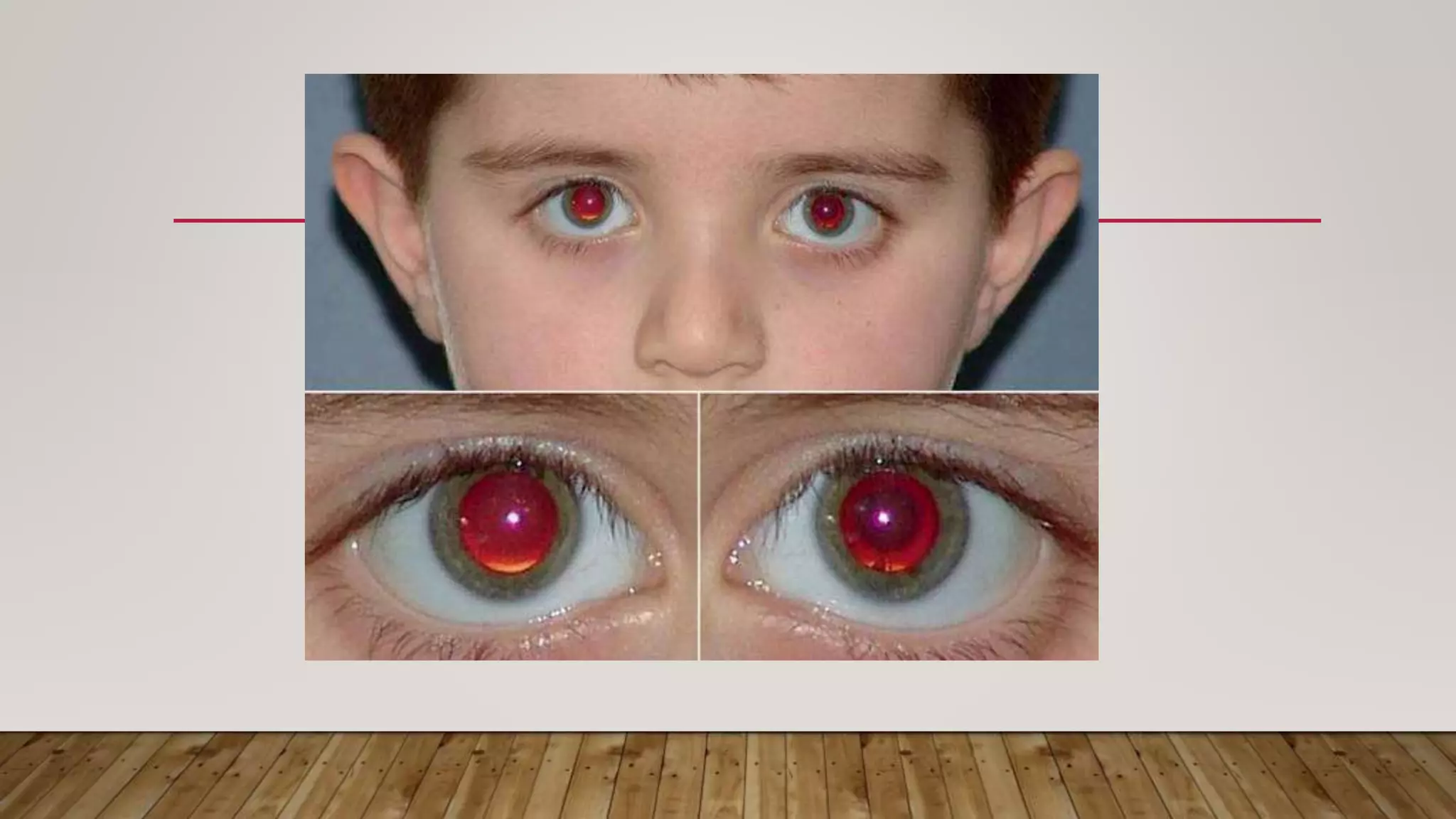 Reflejo del ojo rojo | PPTX