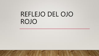Reflejo del ojo rojo | PPTX