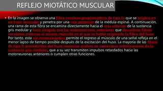Reflejo miotático con base en el libro Guyton | PPTX