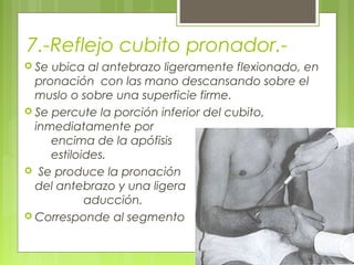 Reflejos | PPT