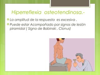 Reflejos | PPT