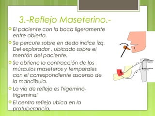 Reflejos | PPT