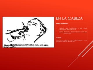 Reflejos | PDF