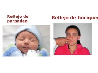 Reflejos-del-recien-nacido.pdf . | PDF