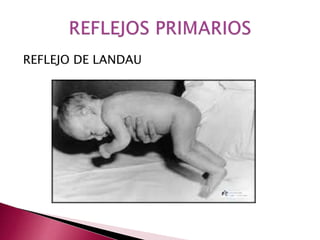 Reflejos del bebé | PPTX