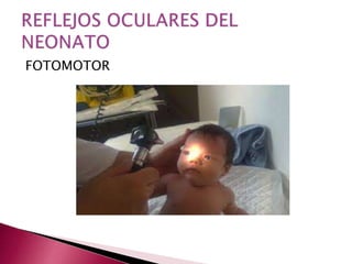 Reflejos del bebé | PPTX