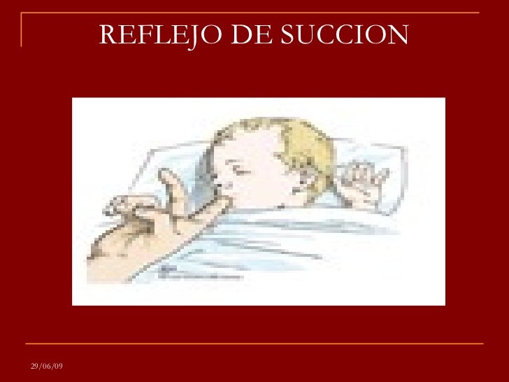 Reflejos del Recien Nacido