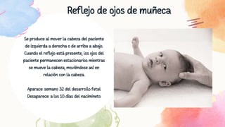 Reflejos neonatales para exploración neurologica del recien nacido | PDF