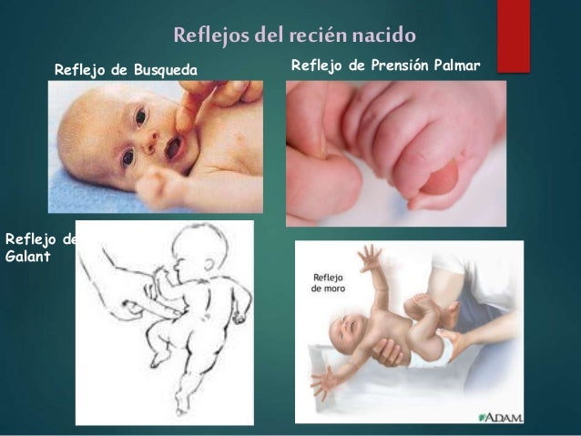 Reflejos neuropediatria