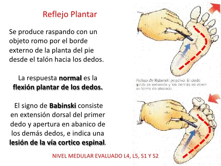 Reflejos superficiales