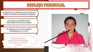 Reflejos tendinoperiósticos o profundos | PPTX