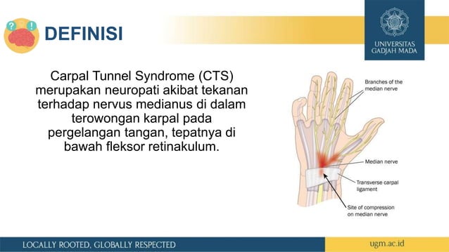 refleksi-kasus-cts-sandy-nur-vania-3.pptx