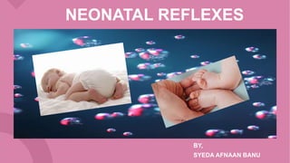 Reflex | PPT