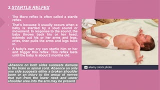 Reflex | PPT