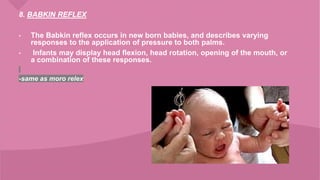 Reflex | PPT