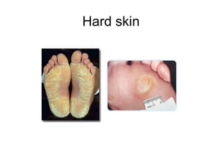 Reflexology-common skin diseases and disorders | PPT