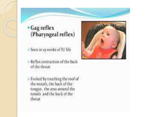 Reflexes | PPTX