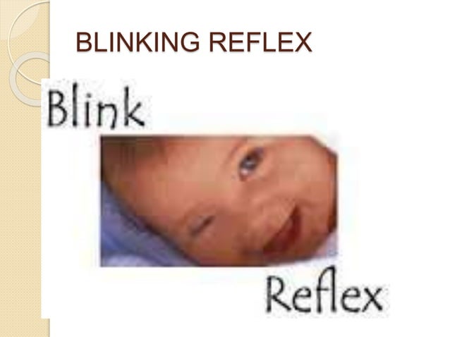 Reflexes | PPT