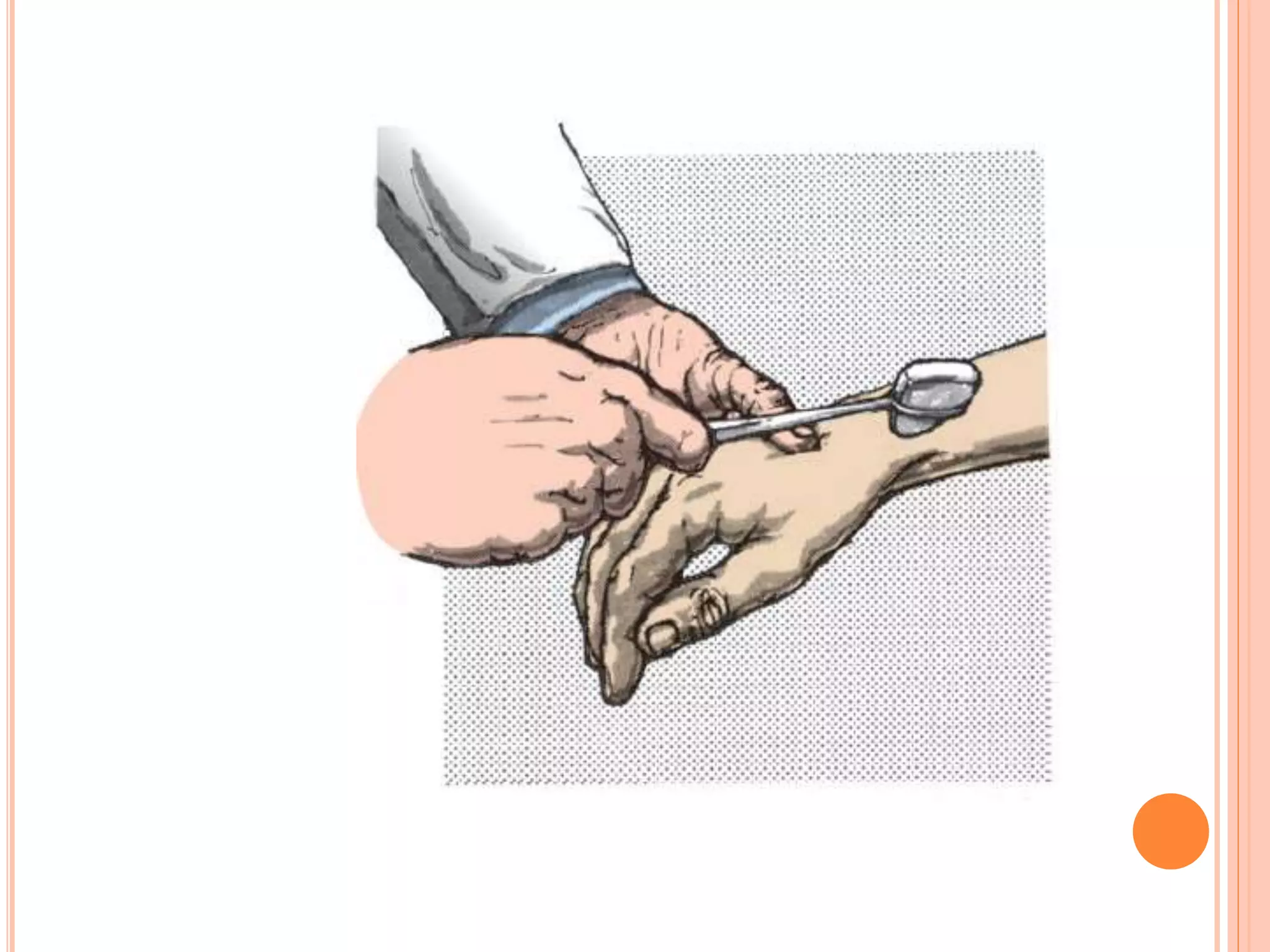 Reflexes - Superficial and Deep tendon reflexes | PPTX