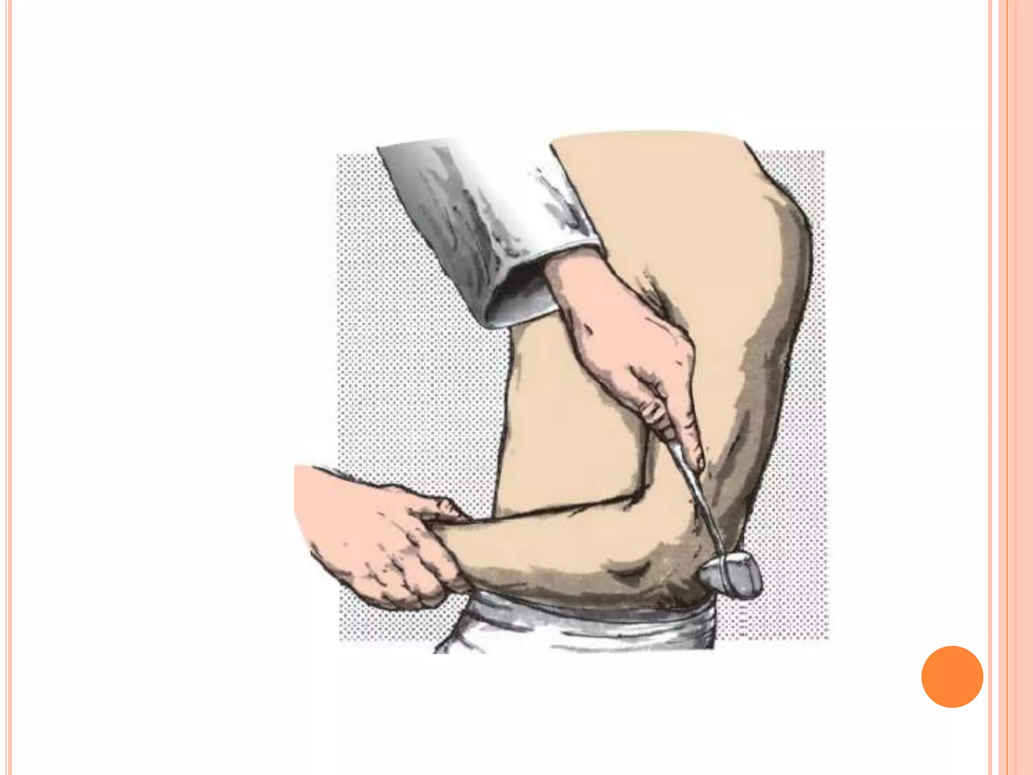 Reflexes - Superficial and Deep tendon reflexes | PPTX