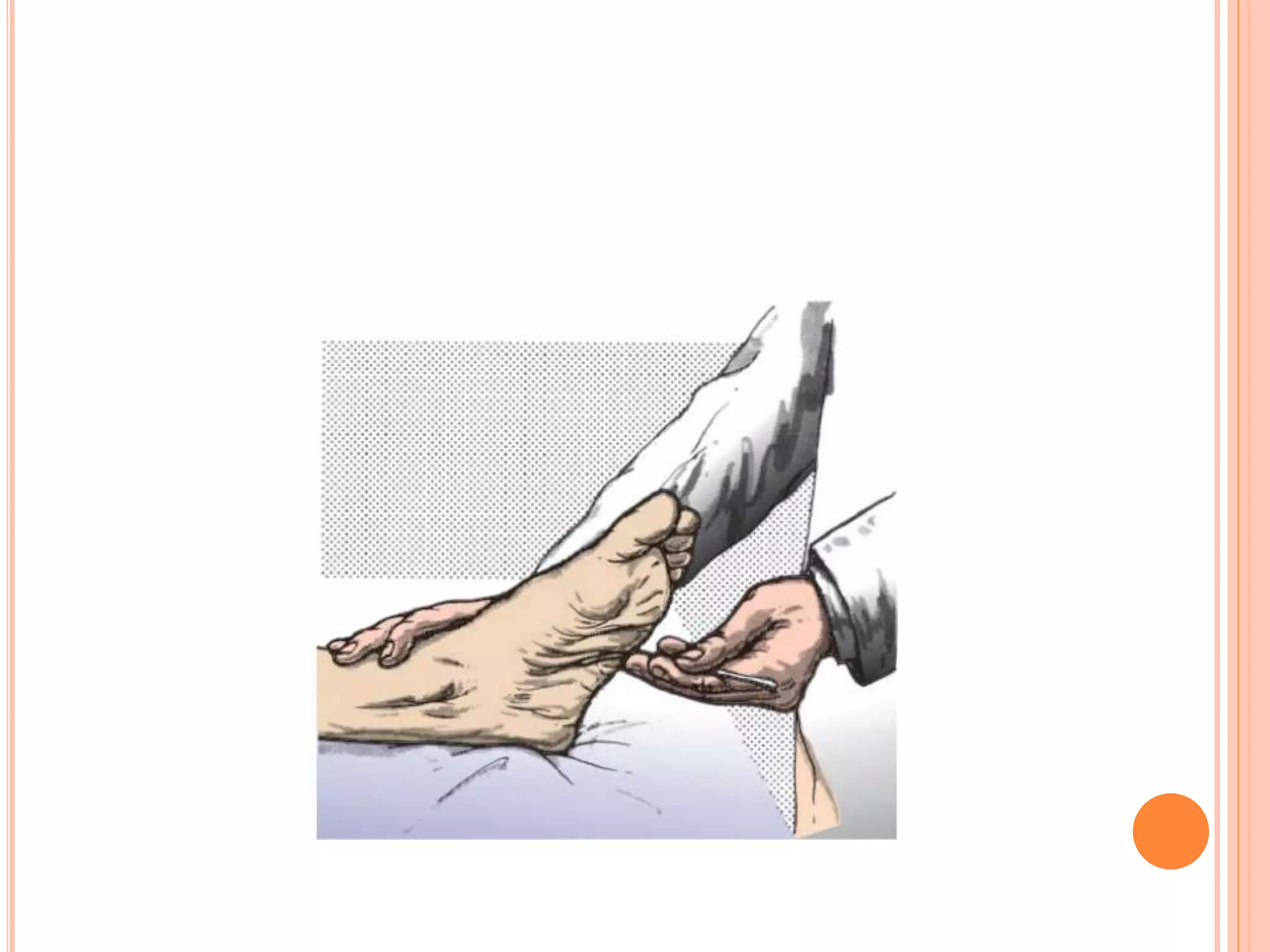 Reflexes - Superficial and Deep tendon reflexes | PPTX