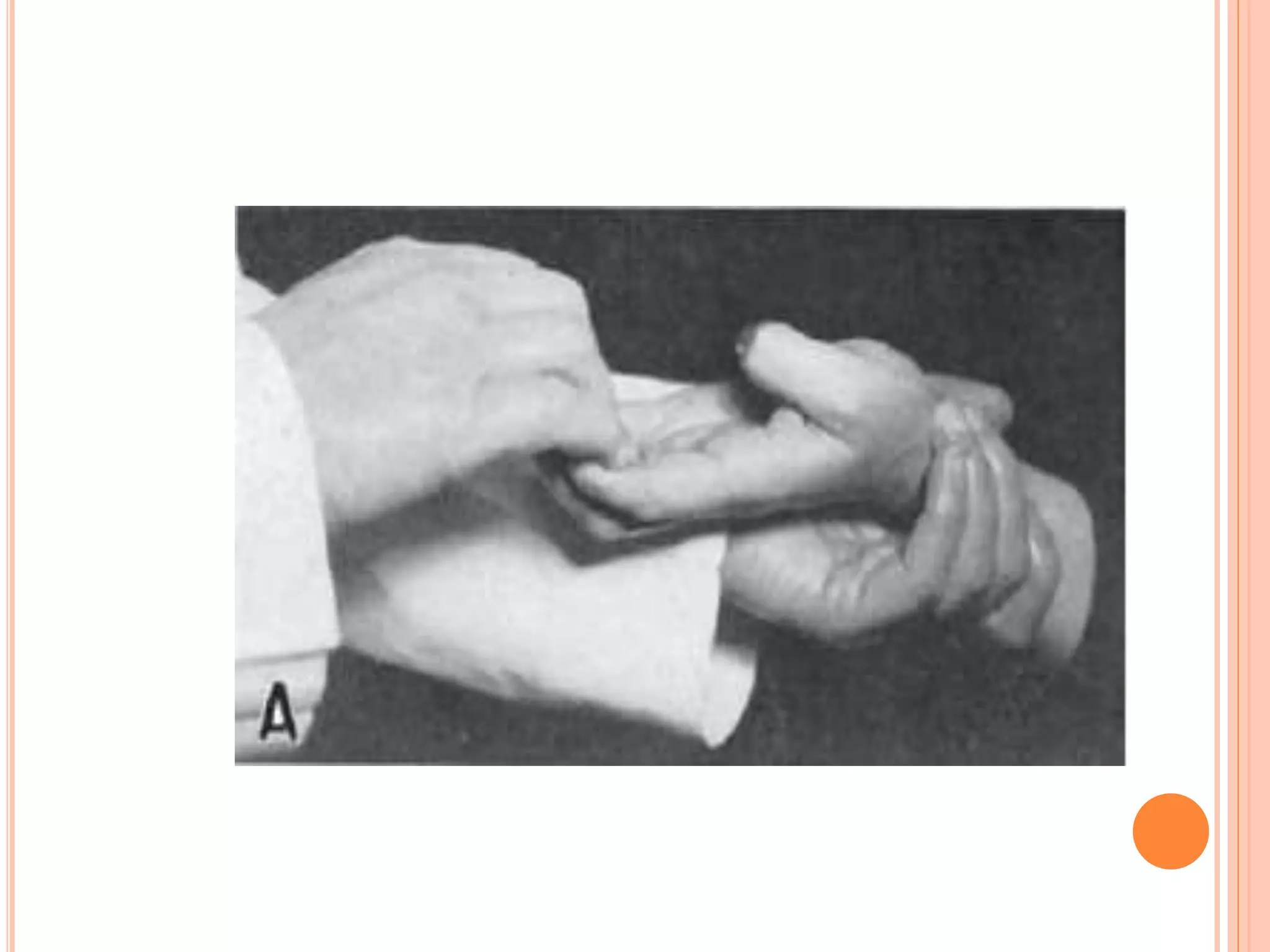 Reflexes - Superficial and Deep tendon reflexes | PPTX