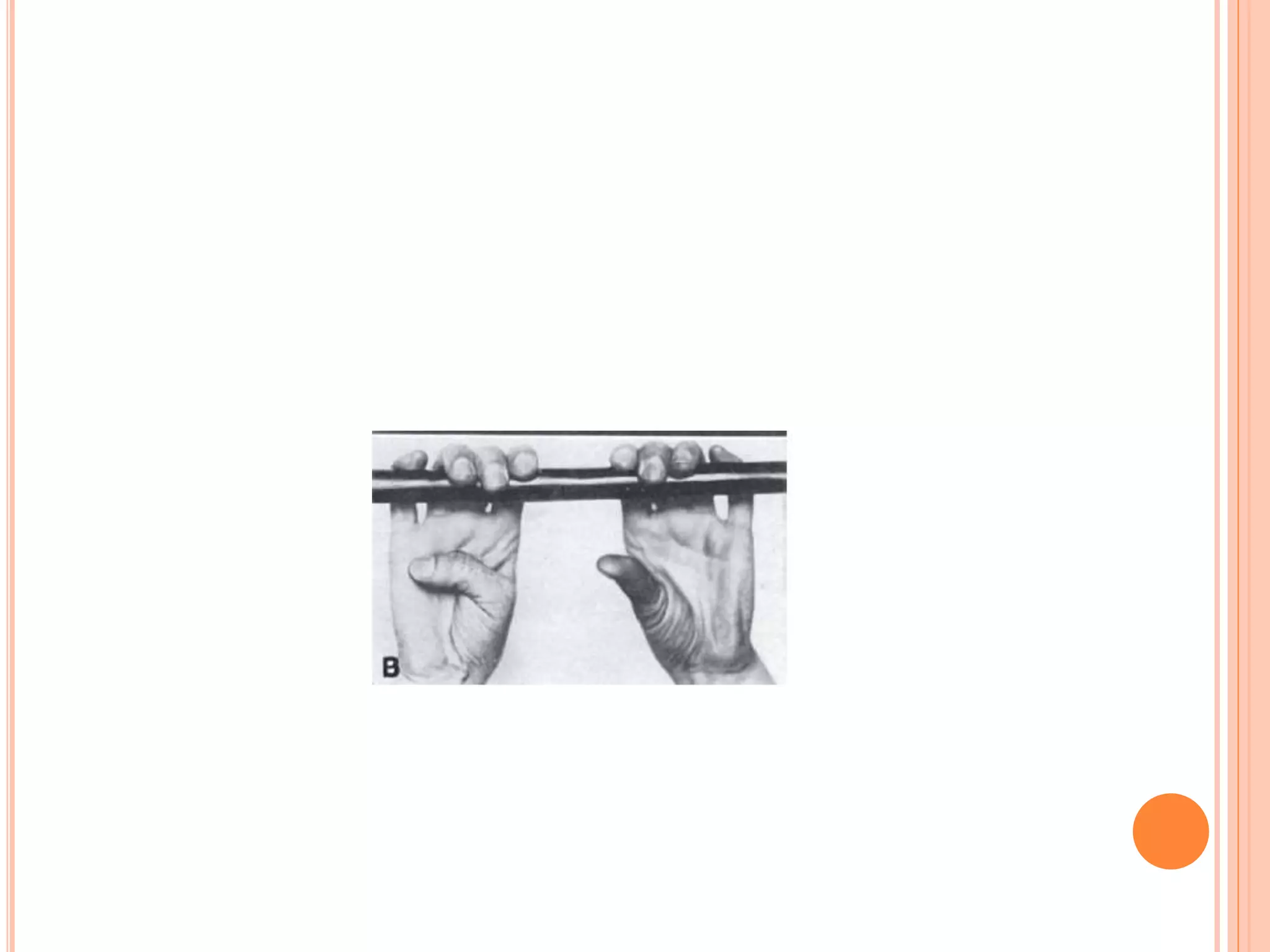 Reflexes - Superficial and Deep tendon reflexes | PPTX