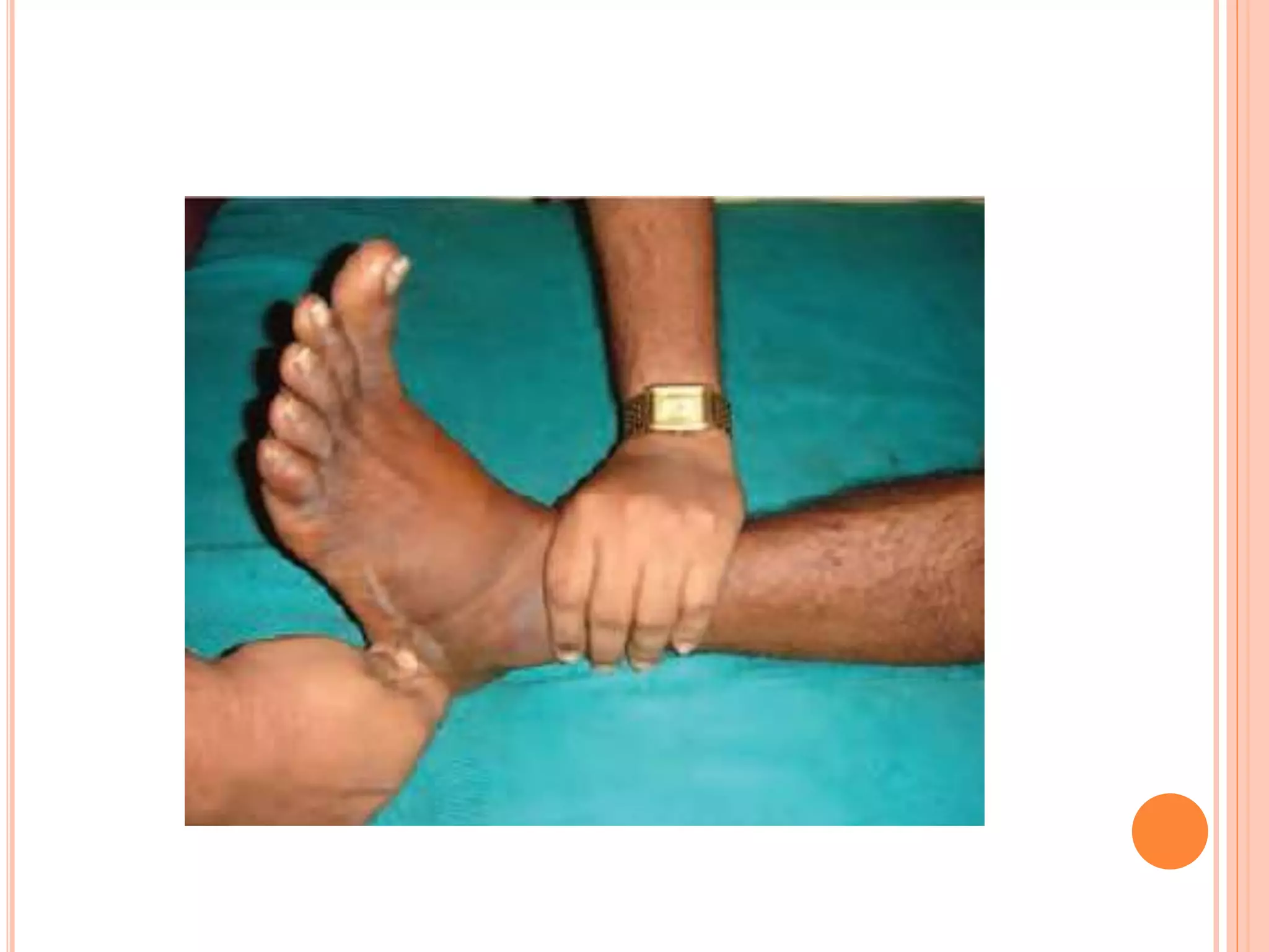 Reflexes - Superficial and Deep tendon reflexes | PPTX