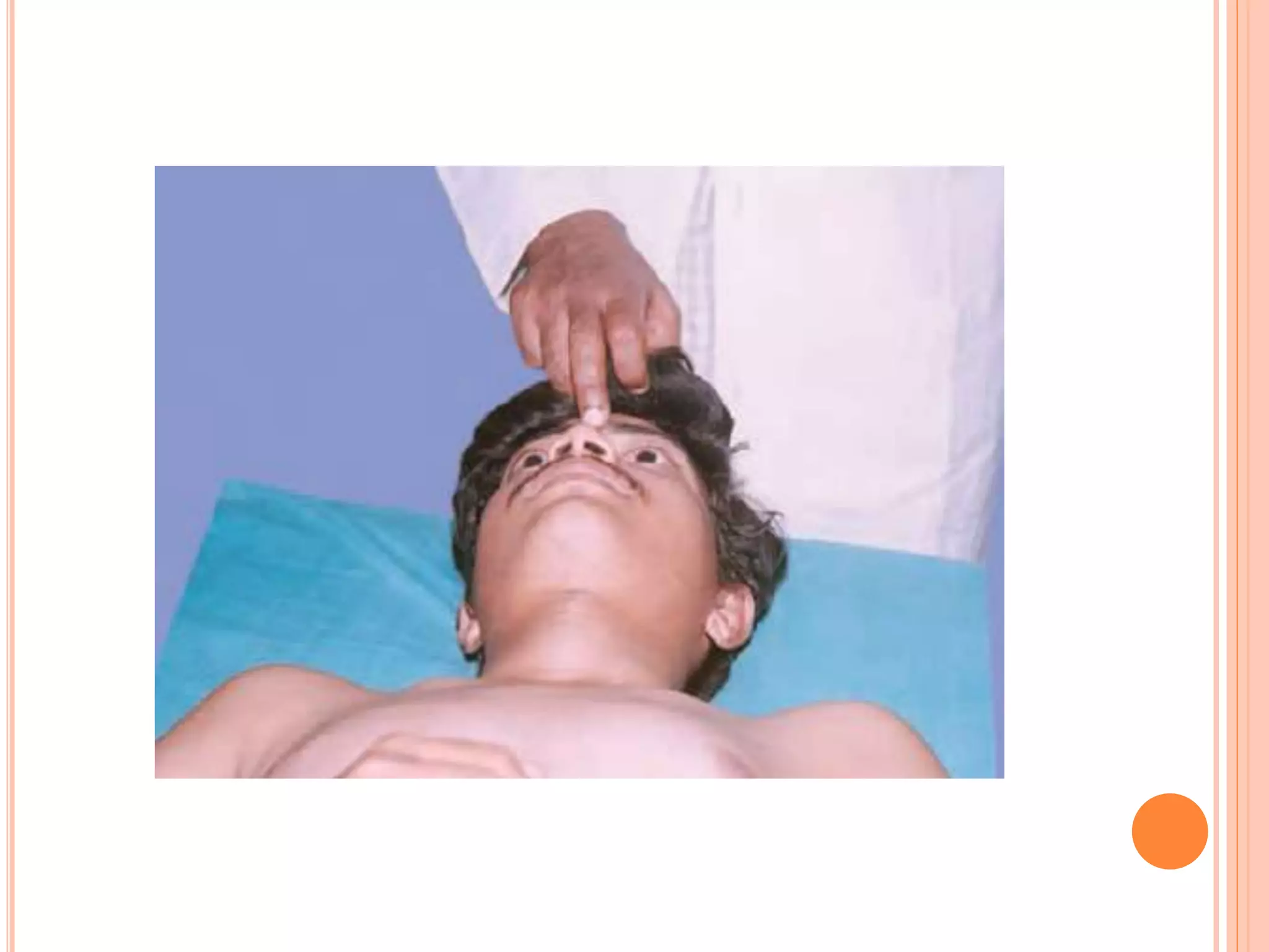 Reflexes - Superficial and Deep tendon reflexes | PPTX