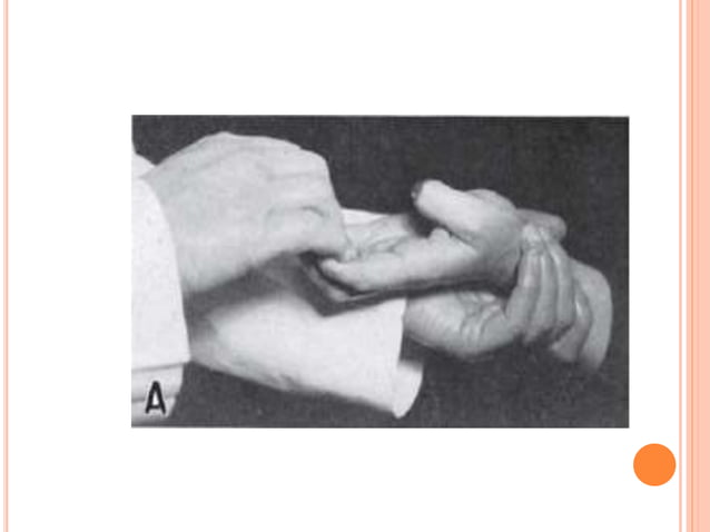 Reflexes - Superficial and Deep tendon reflexes | PPTX