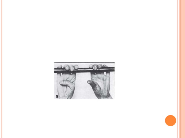 Reflexes - Superficial and Deep tendon reflexes | PPTX