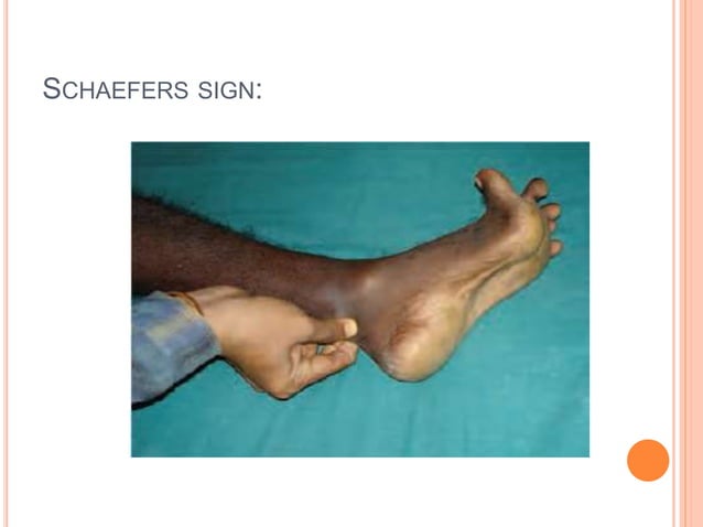 Reflexes - Superficial and Deep tendon reflexes | PPTX