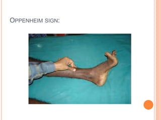 Reflexes - Superficial and Deep tendon reflexes | PPTX