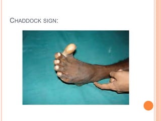 Reflexes - Superficial and Deep tendon reflexes | PPTX