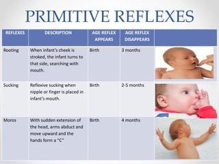 Pediatric Primitive Reflexes Maneuver And Ages Palmar, 48% OFF