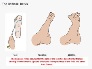 Reflexes | PPTX