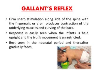 Trunk Incurvation Reflex