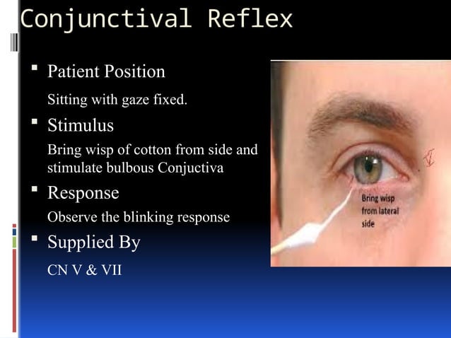 Reflex Examination, Introduction and Procedure | PPTX | Death, Injury, or Military Conflict ...