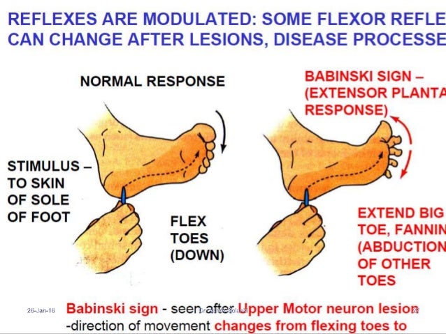 reflexes, clasifications, and functions.