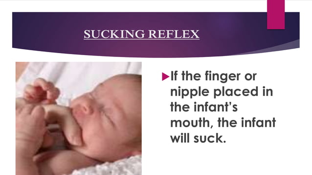 Reflexes | PPTX | Parenting Babies and Toddlers | Parenting