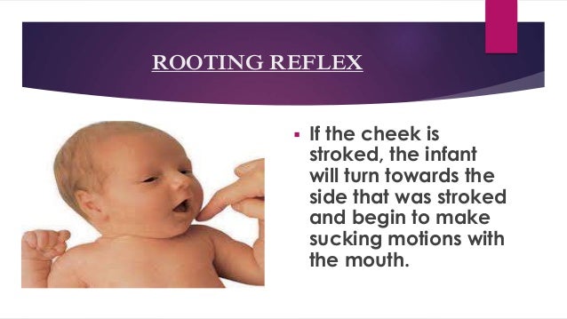 rooting reflex definition | rooting reflex ncbi pdf – KFSWCU