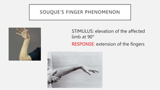 REFLEXES-PLP.pptx