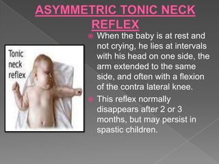 Reflexes present at birth | PPTX