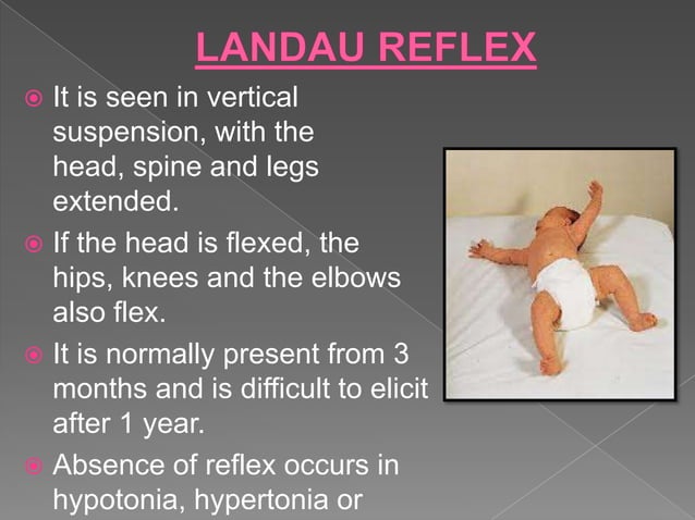 Reflexes present at birth | PPT