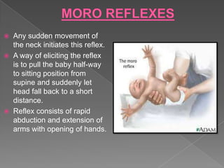 Reflexes present at birth | PPTX