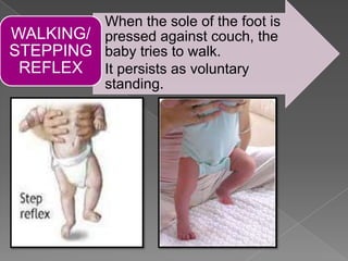 Reflexes present at birth | PPTX