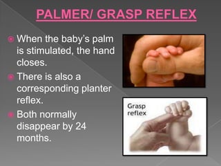 Reflexes present at birth | PPTX