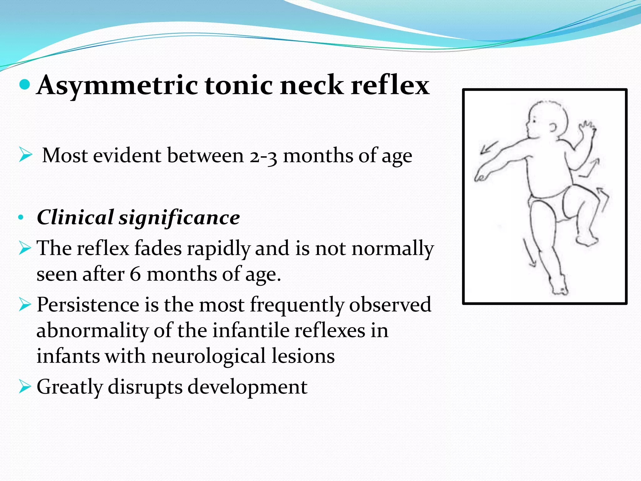 Reflexes present in infants | PPTX