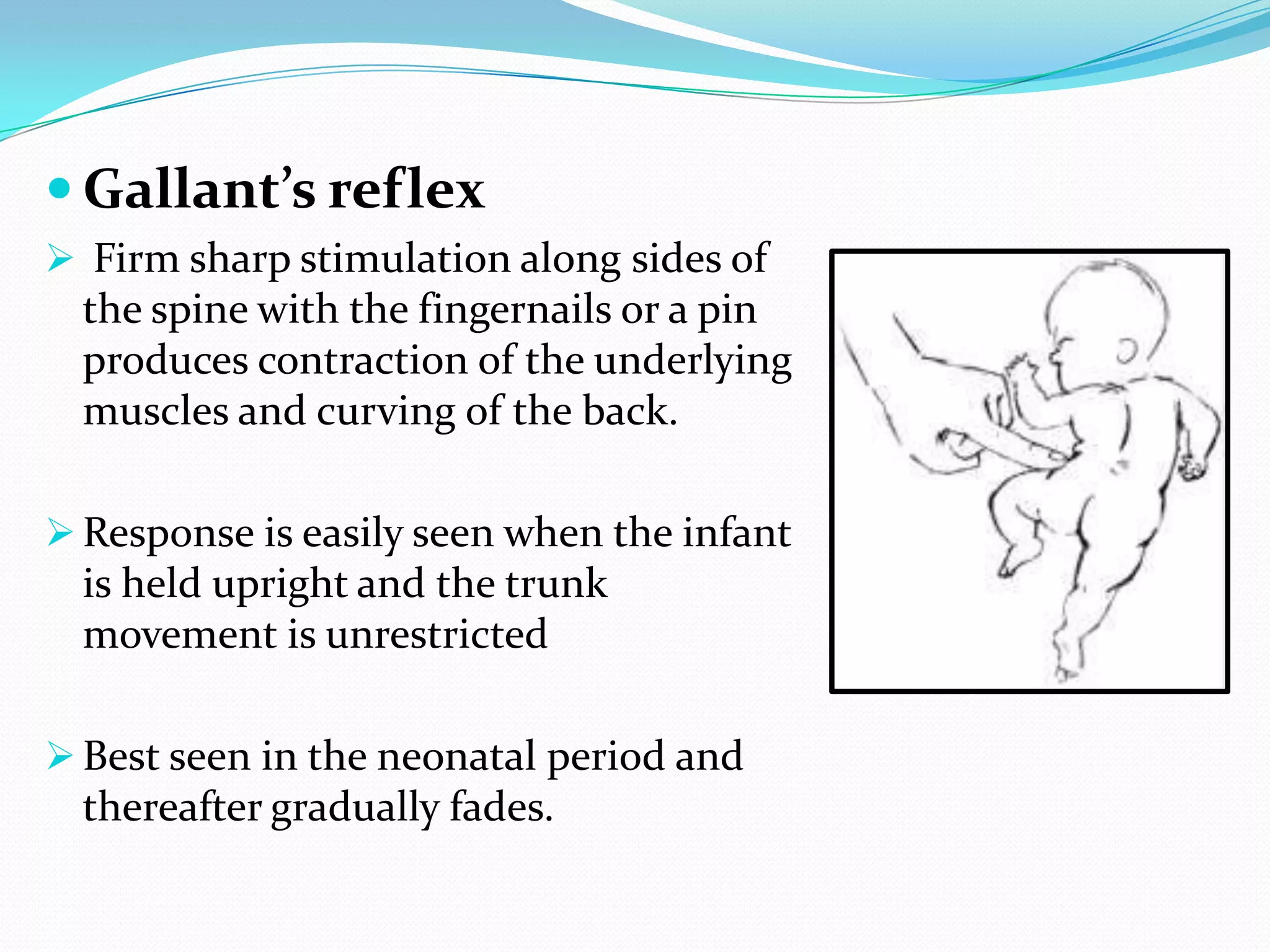 Reflexes present in infants | PPTX