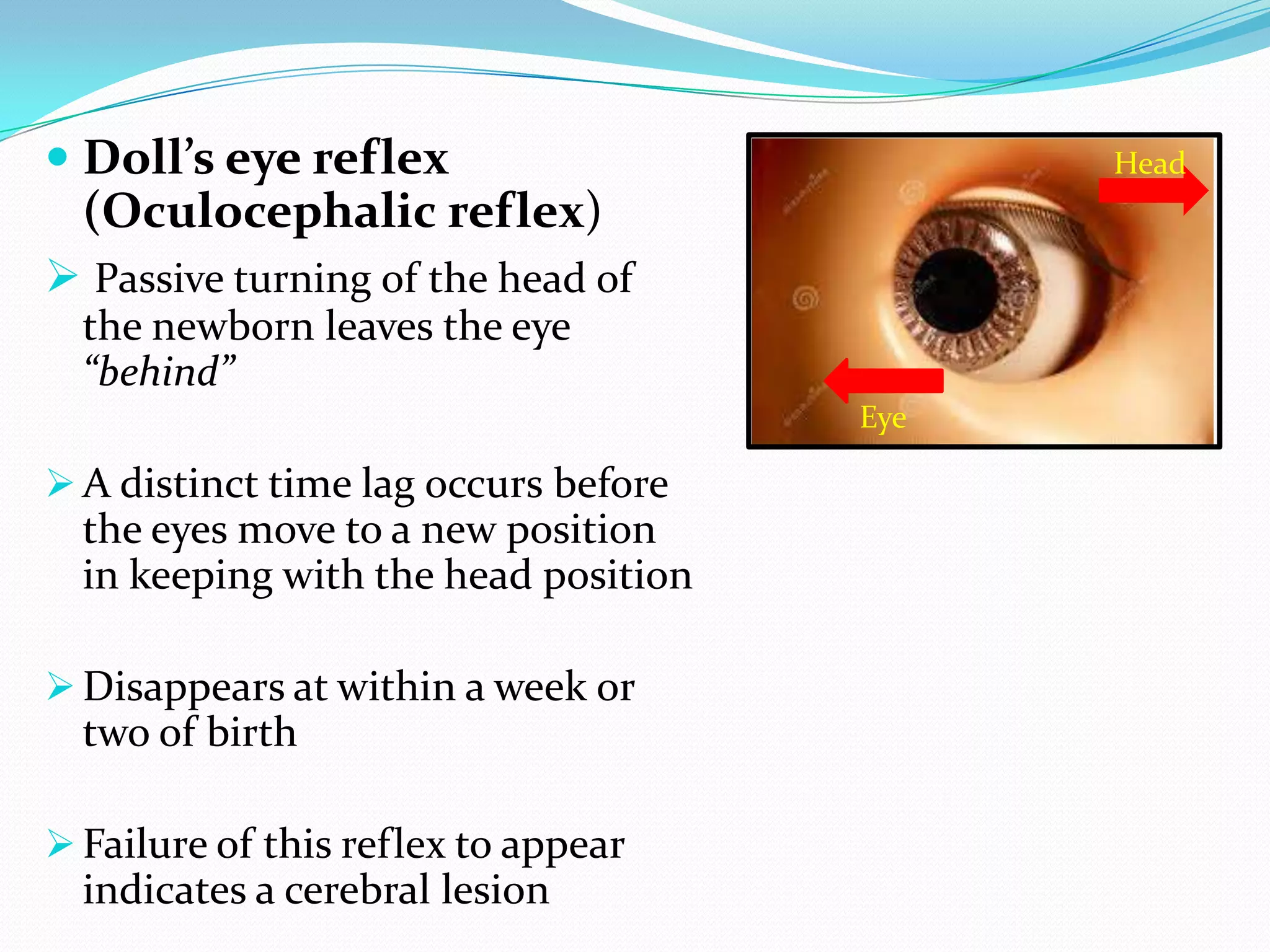 Reflexes present in infants | PPTX